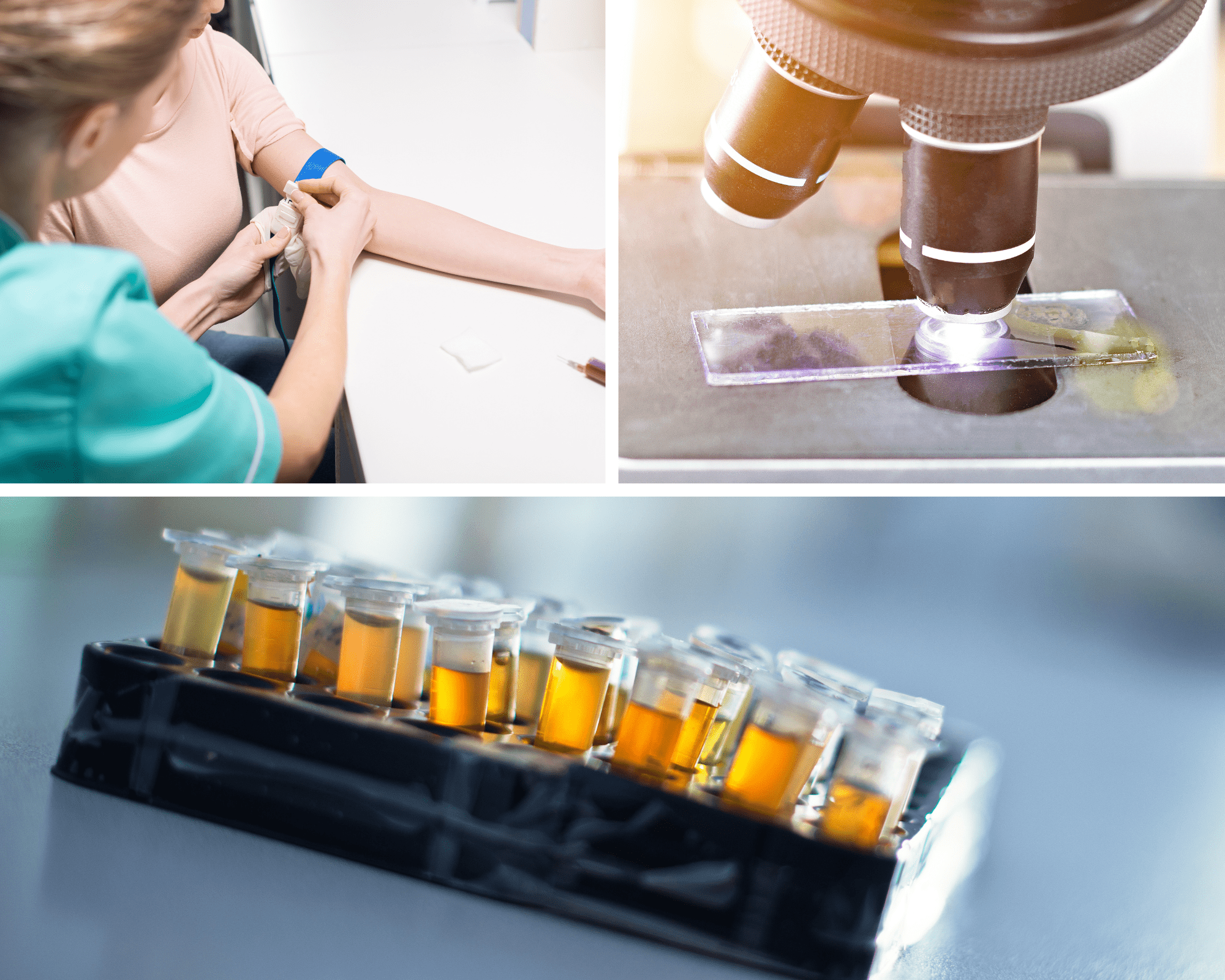 Blutanalyse Ästhetik